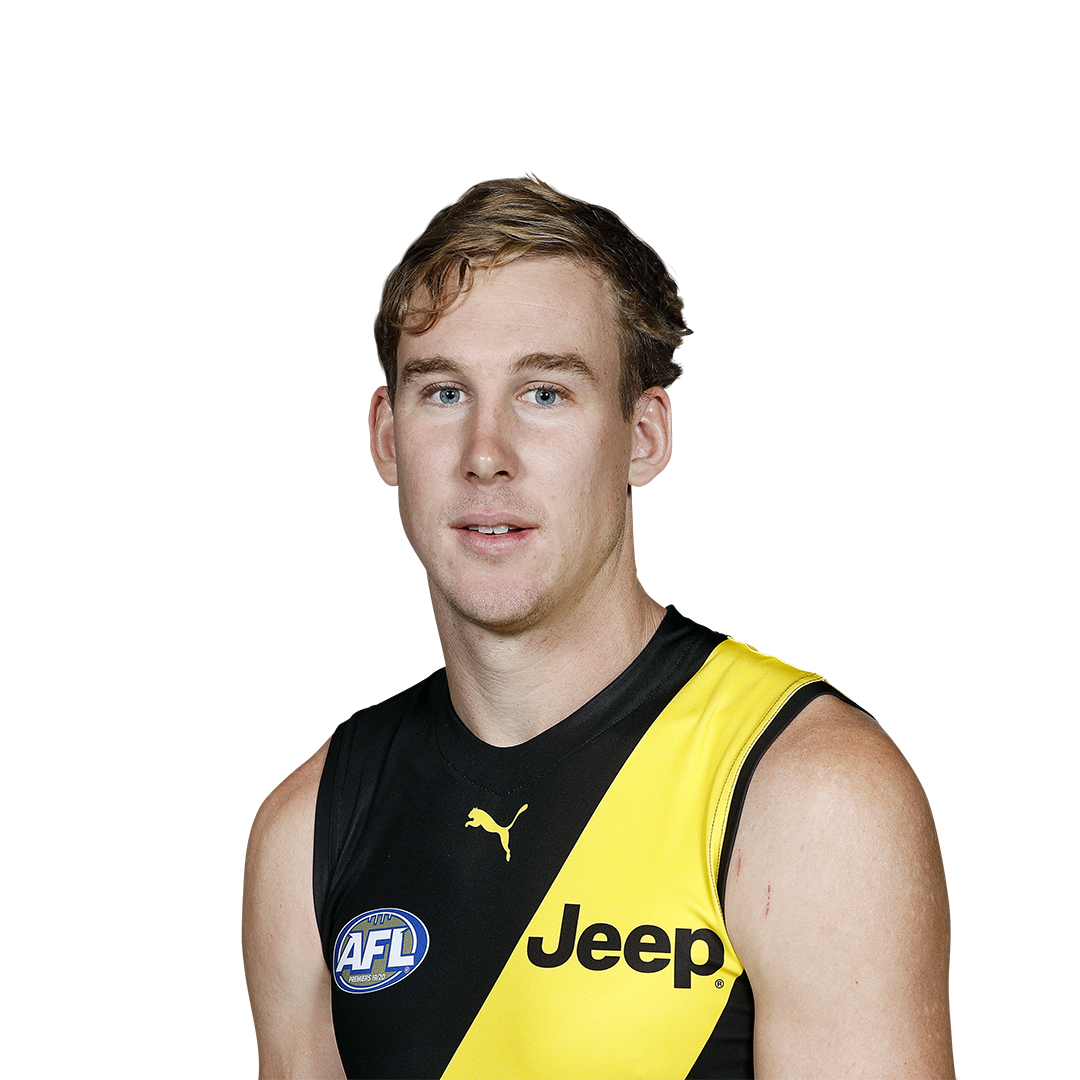 Tom J Lynch | Richmond Tigers | Player Profile | SuperCoach & AFL ...
