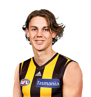 AFL Player - #23: Harrison Jones - Big ankle bruise, big two-year ...
